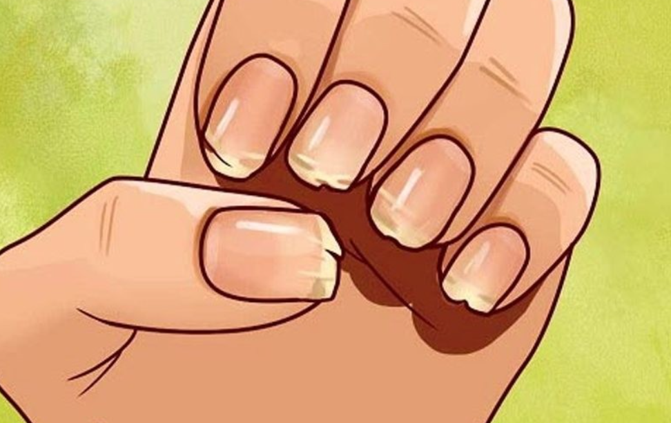 Brittle nails: 6 tips to strengthen them naturally – GRANDMA’S TRICKS
