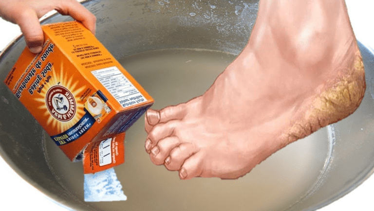 8 natural tips for dry and damaged feet – GRANDMA’S TRICKS